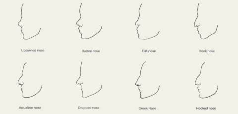 What is Upturned Nose Rhinoplasy? | Dr. Cat Plastic Surgery